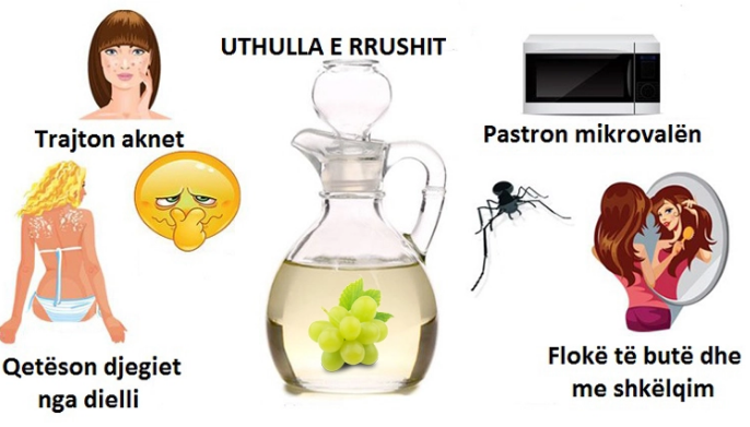 Nga zhdukja e milingonave tek flokët e ashpër, 4 arsyet përse duhet të ...