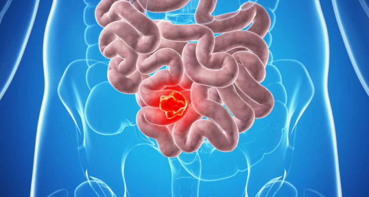 Shkencëtarët zbulojnë se qindra baktere të zorrëve janë elektrike ...